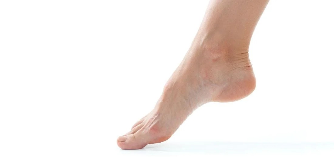 Drop Foot - MedSpire